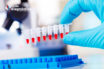 Diagnóstico de la meningitis: enfoques de diagnóstico - Todo Diagnóstico