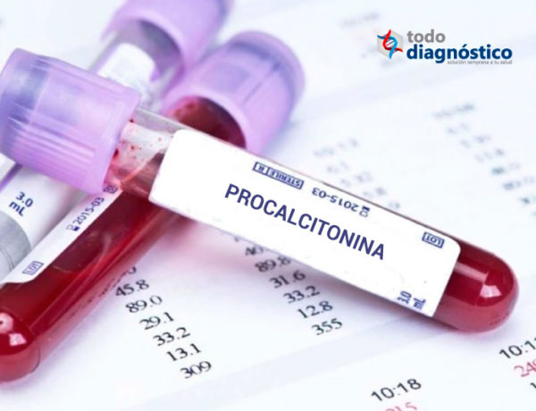 Procalcitonina: biomarcador de sepsis bacteriana - Todo Diagnóstico